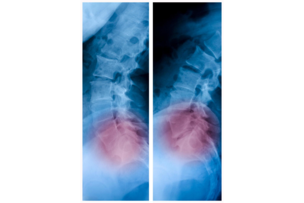 Trigger Point Therapy - PremierMED